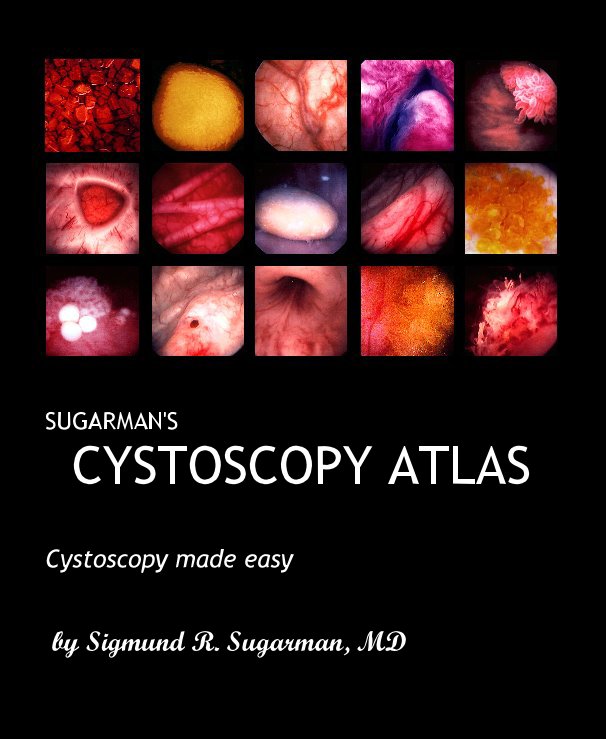 Sugarmans Cystoscopy Atlas By Sigmund R Sugarman Md Blurb Books