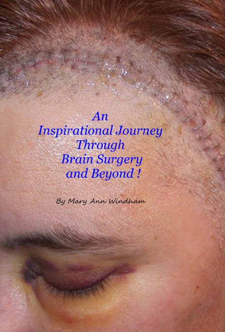 An Inspirational Journey Through Brain Surgery and Beyond ! by Mary Ann ... An Inspirational Journey Through Brain Surgery and Beyond ! by Mary Ann ...